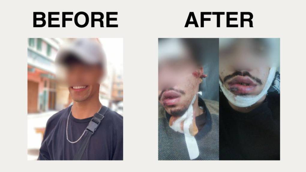 Help Omar smile again | Chuffed | Non-profit charity and social ...