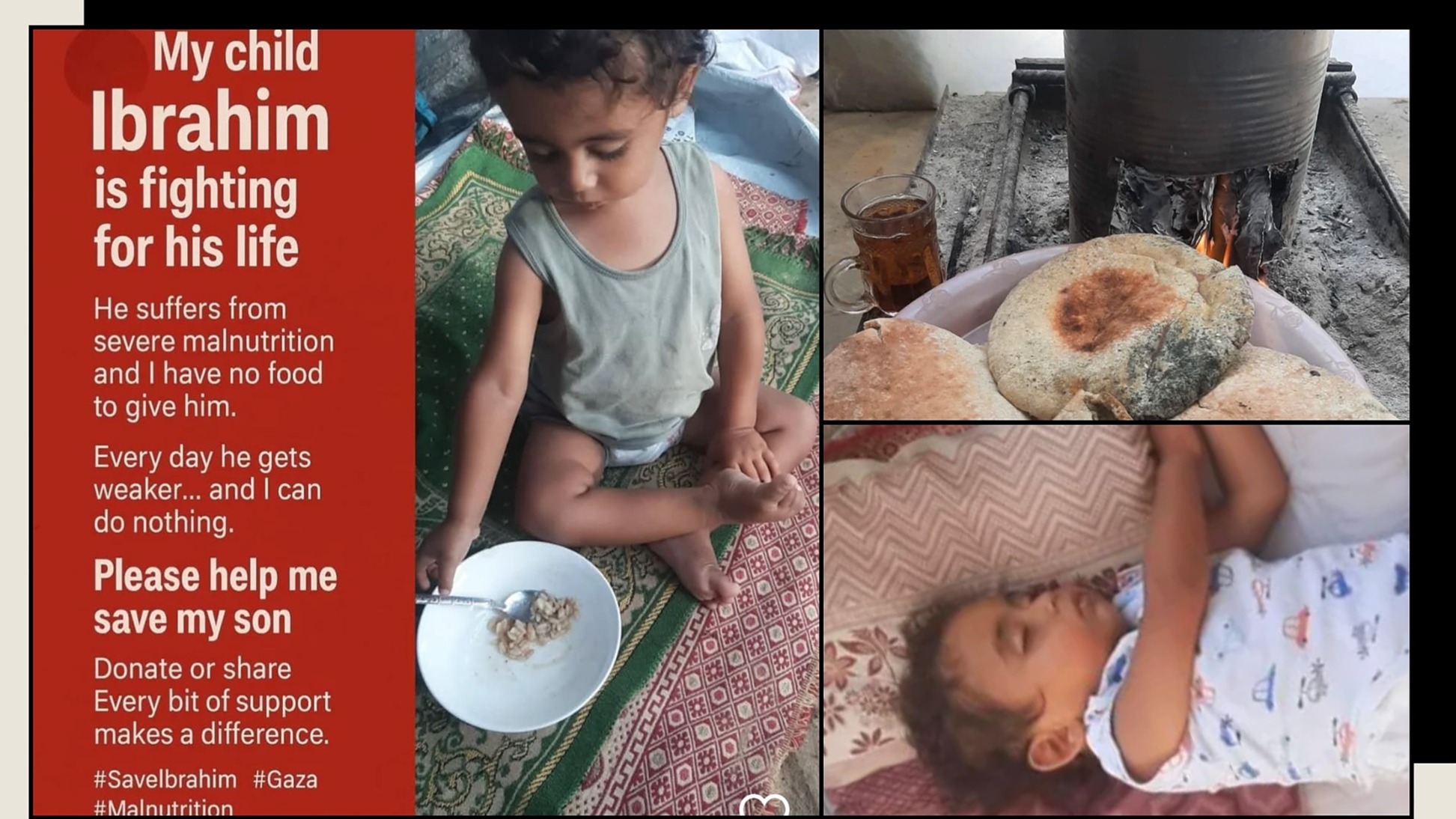 Help my child Ibrahim beat malnutrition and get food he need | Chuffed ...