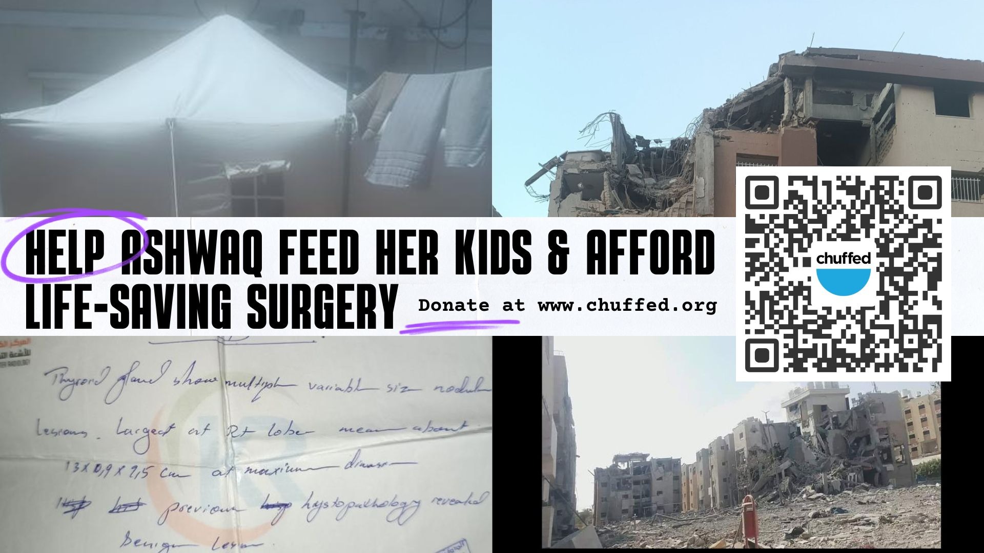 Help Ashwaq Feed Her Kids & Afford Life-Saving Surgery 💔 | Chuffed | Non-profit charity and ...